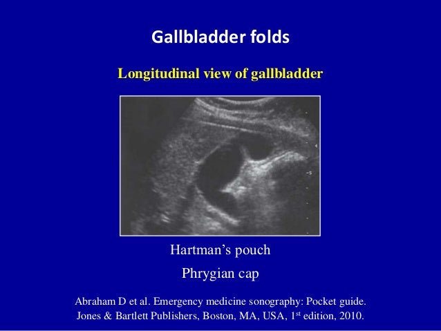 Ultrasound of the gallbladder