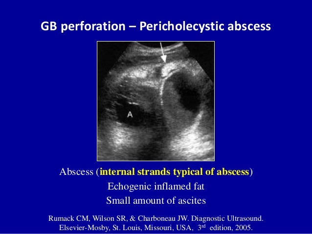 Ultrasound of the gallbladder