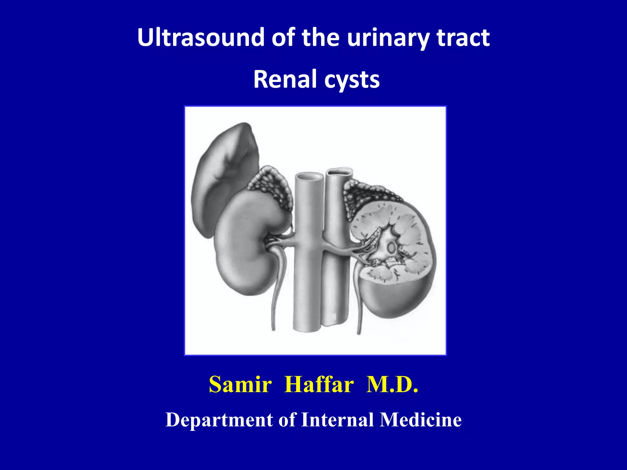 Ultrasound of the urinary tract - Renal cysts | PPTX