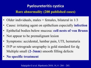 Ultrasound of the urinary tract - Renal tumors | PPTX