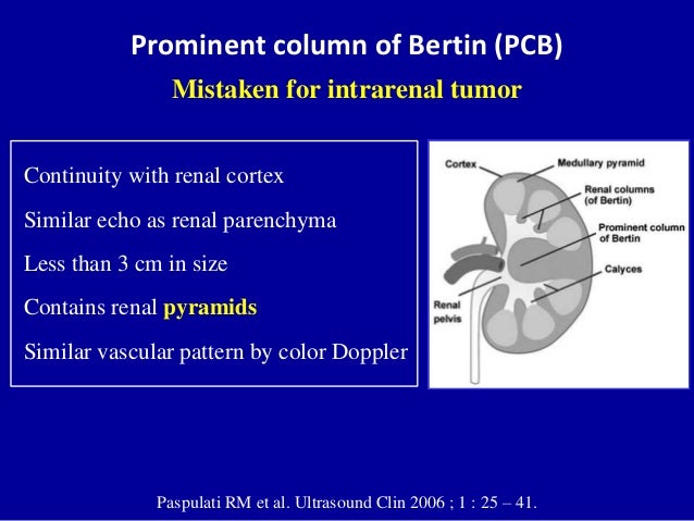Ultrasound of the urinary tract - Renal tumors