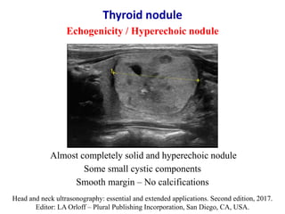 Ultrasound of thyroid nodules | PPTX