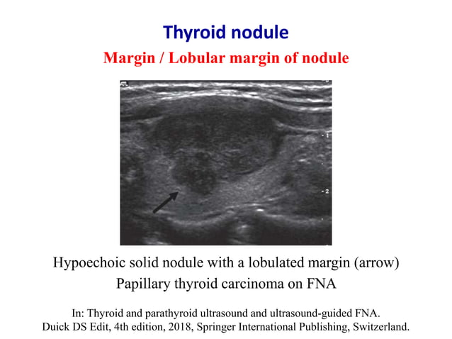 Ultrasound of thyroid nodules | PPTX | Thyroid Disorders | Endocrine ...