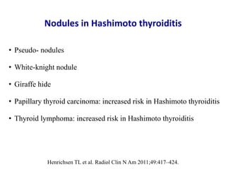 Ultrasound of thyroid nodules | PPTX