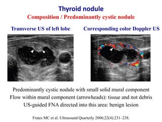 Ultrasound of thyroid nodules | PPT