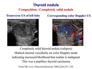 Thyroid Cancer Ultrasound
