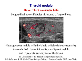 Ultrasound of thyroid nodules | PPT