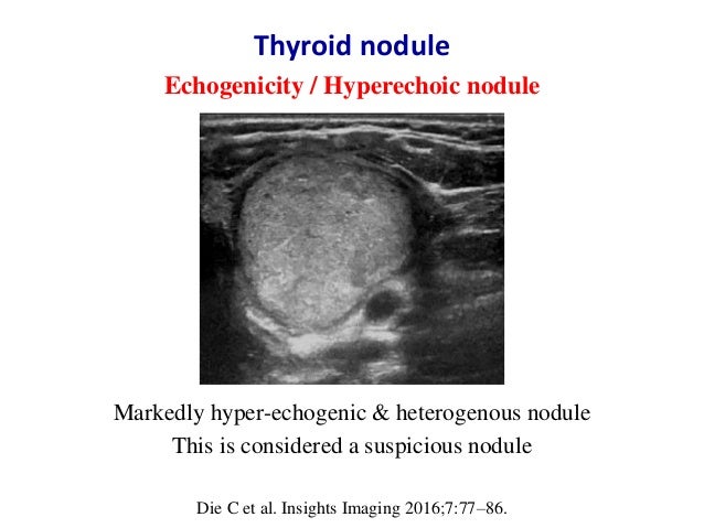 Ultrasound of thyroid nodules