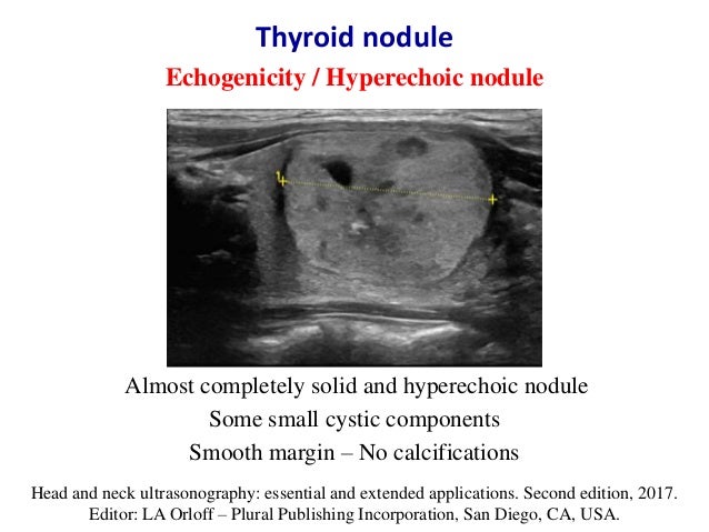 Ultrasound of thyroid nodules
