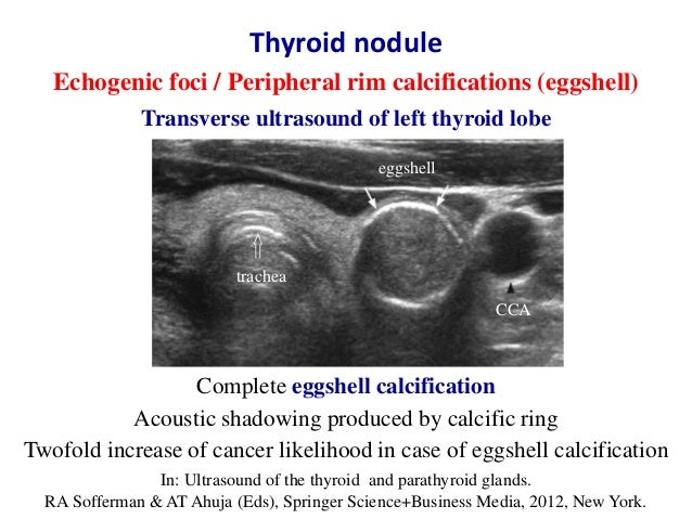 Ultrasound of thyroid nodules