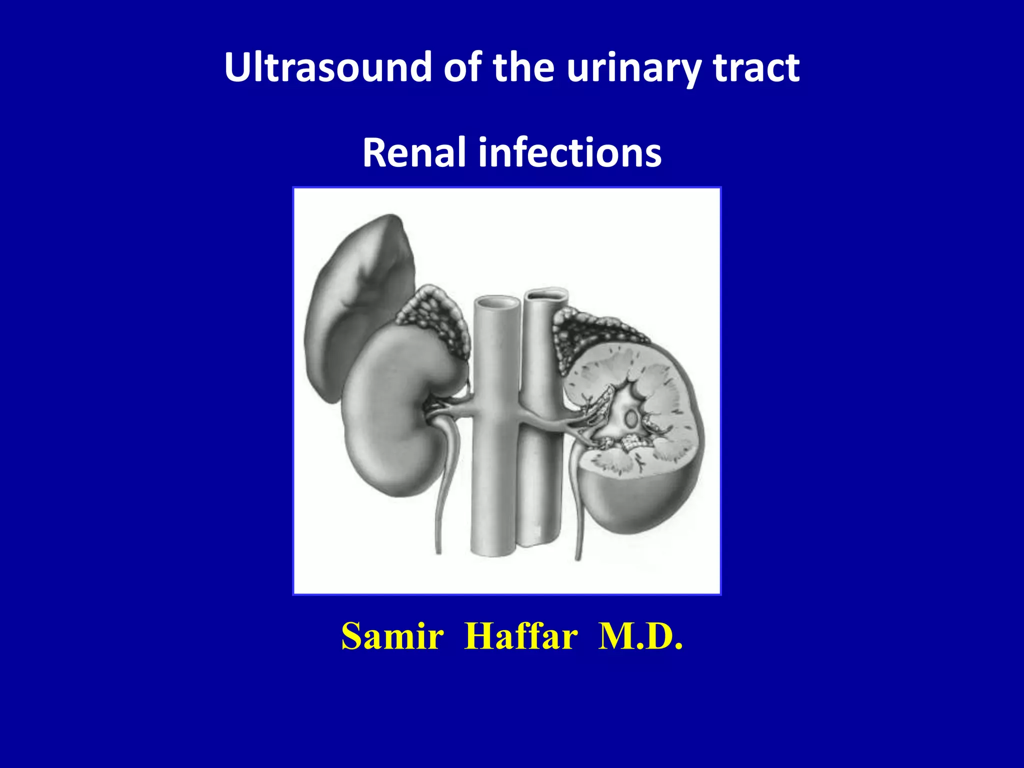 Ultrasound of the urinary tract - Renal infections | PPTX