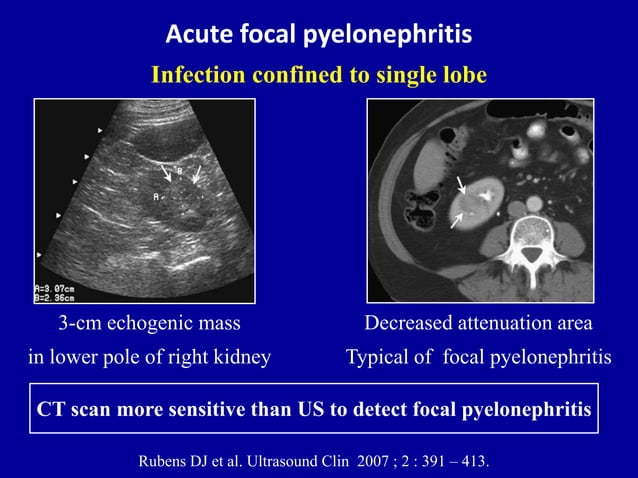 Ultrasound of the urinary tract - Renal infections | PPTX | Ear, Nose ...