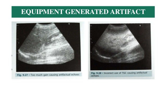Ultrasound physics