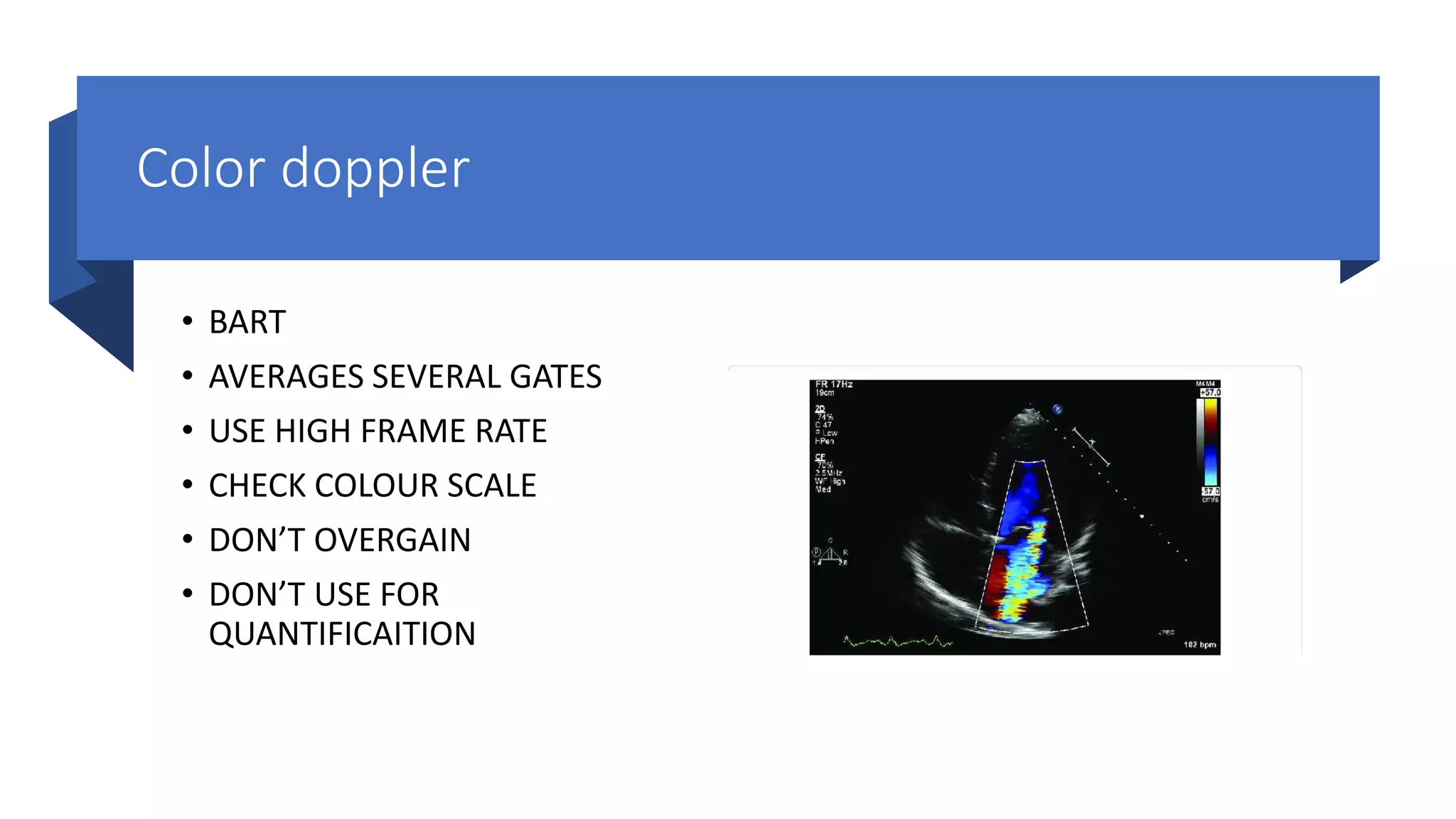 Ultrasound physics | PPTX
