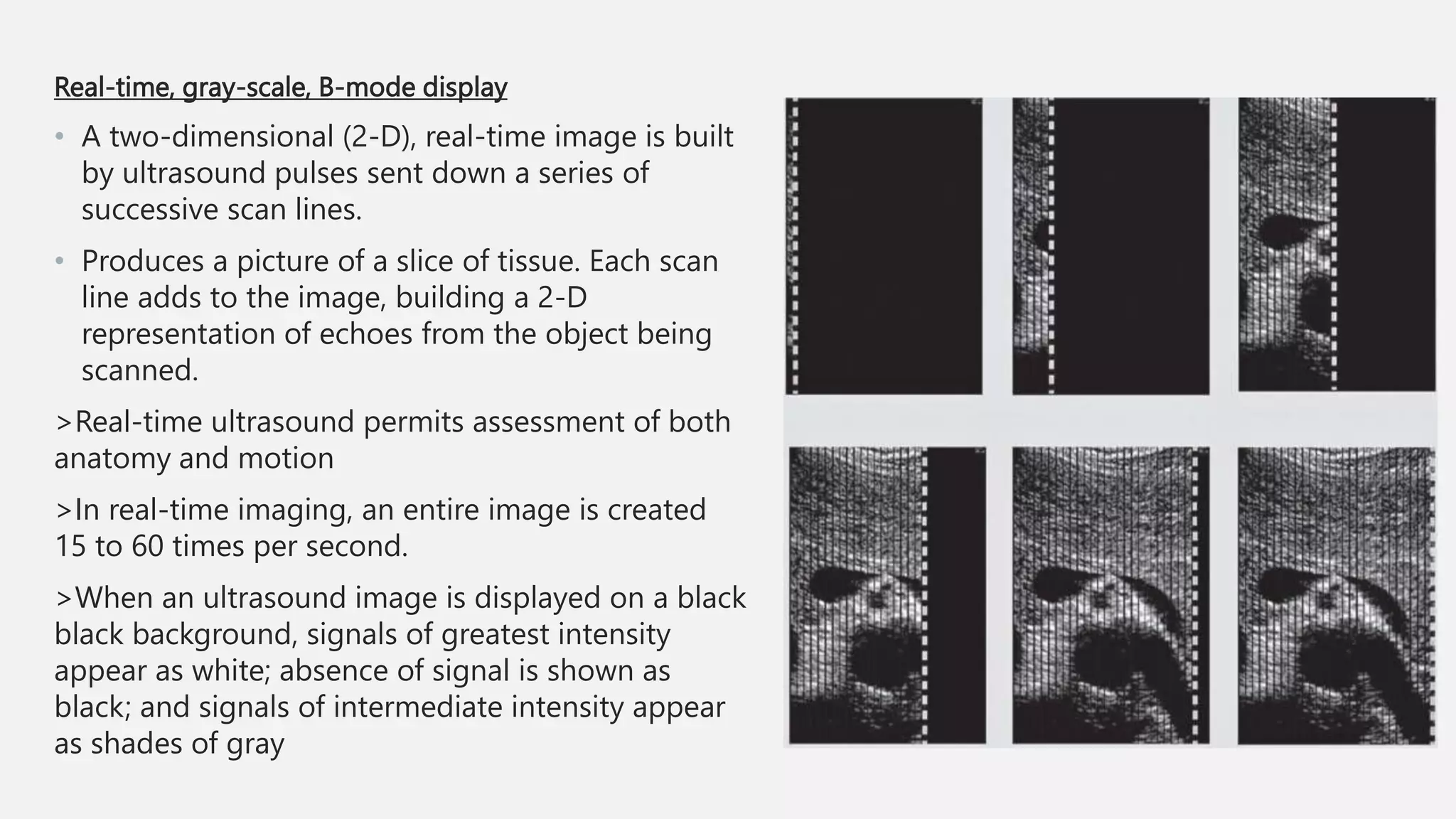 Ultrasound and Doppler physics | PPTX