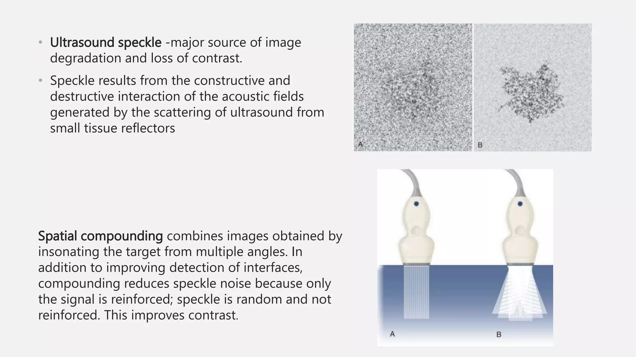 Ultrasound and Doppler physics | PPTX
