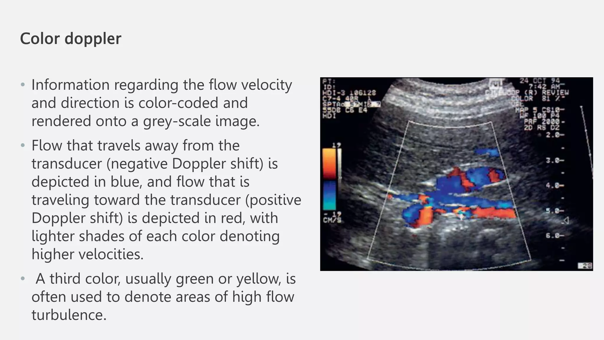 Ultrasound and Doppler physics | PPTX