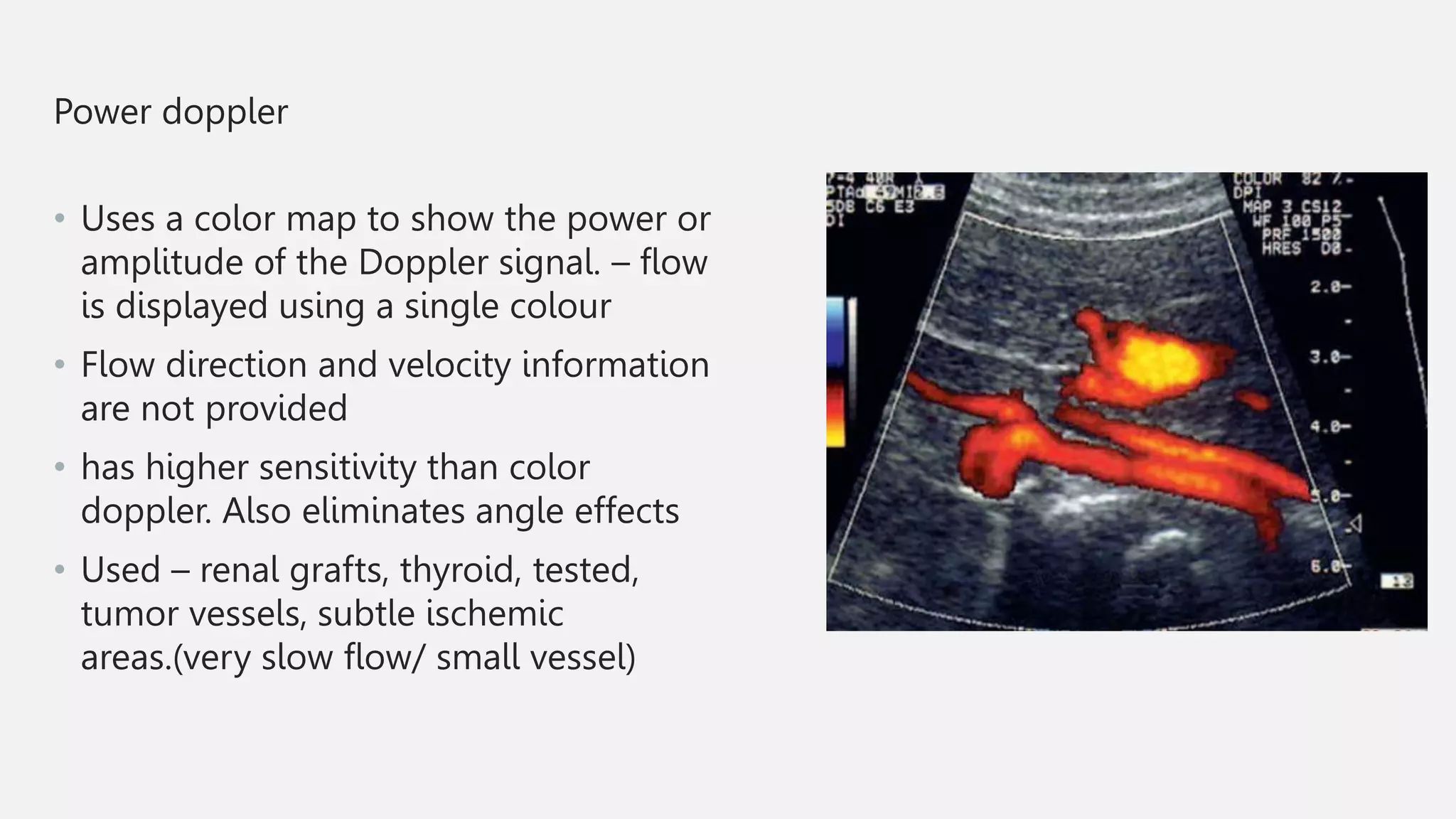 Ultrasound and Doppler physics | PPTX