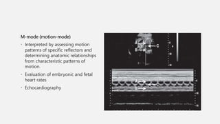 Ultrasound and Doppler physics | PPTX