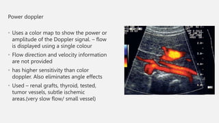 Ultrasound and Doppler physics | PPTX