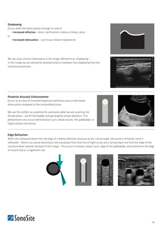 Ultrasound Physics for Beginner's and students | PDF