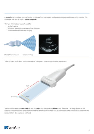 Ultrasound Physics for Beginner's and students | PDF