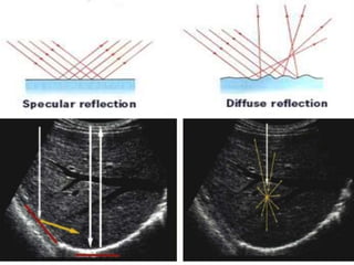 Specular Reflection Ultrasound