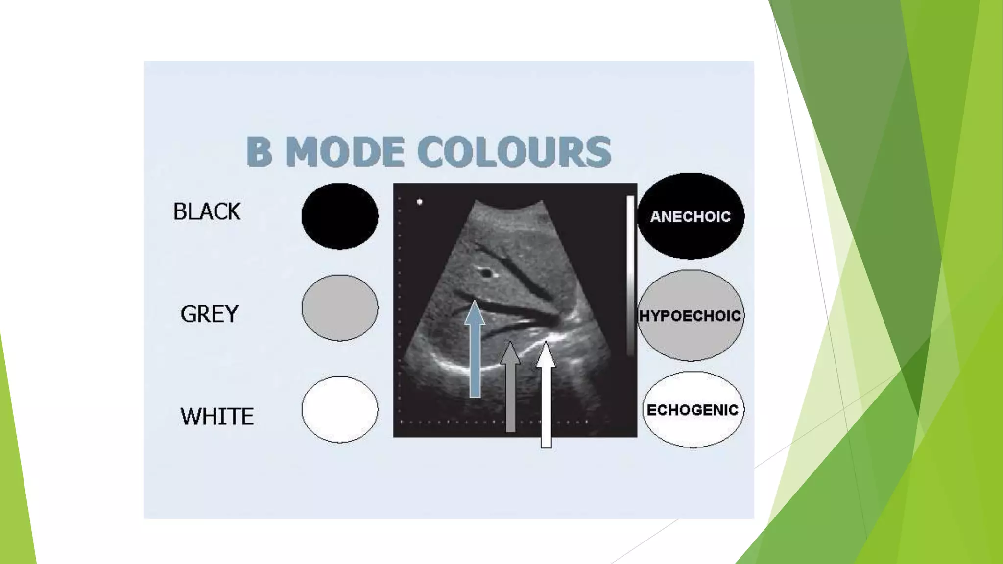 Ultra sound physics CMU.pptx