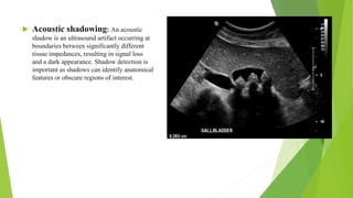 Ultra sound physics CMU.pptx