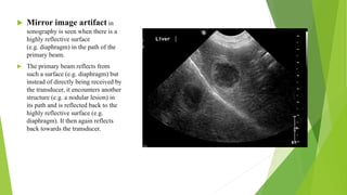Ultra sound physics CMU.pptx