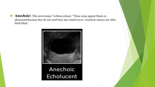 Ultra sound physics CMU.pptx