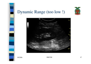 Ultrasound Physics & Knobology | PDF