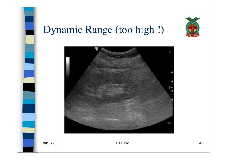 Ultrasound Physics Knobology ultrasound-physics-knobology