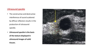 ULTRASOUND PHYSICS PPT 2 vjhvjhgjvhvjhvj | PPTX