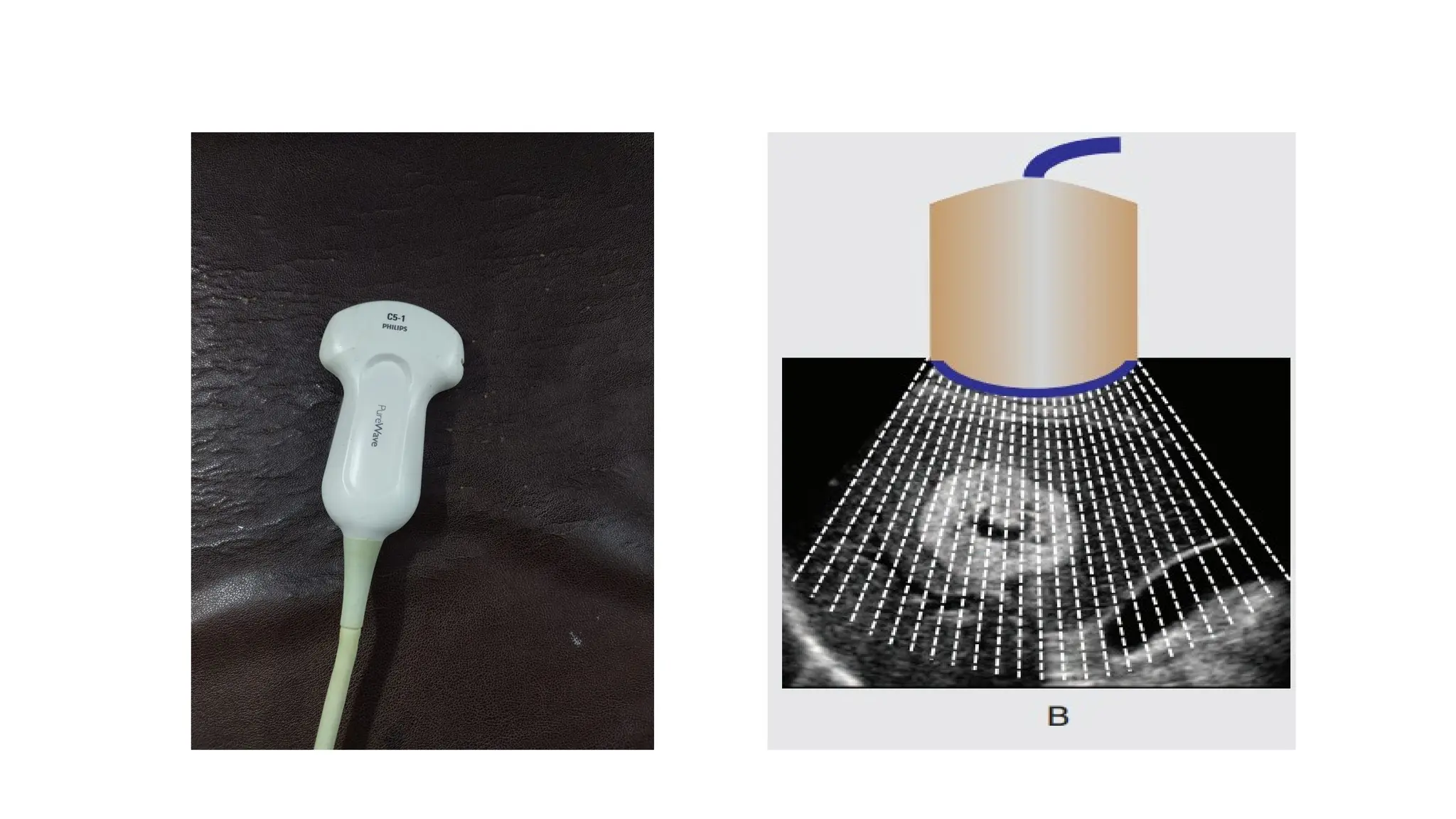 Ultrasound Physics Ppt 2 Pptxhhhhhhhhhhhh Ppt