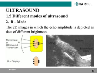 Ultrasound Presentation 12000000000.pptx