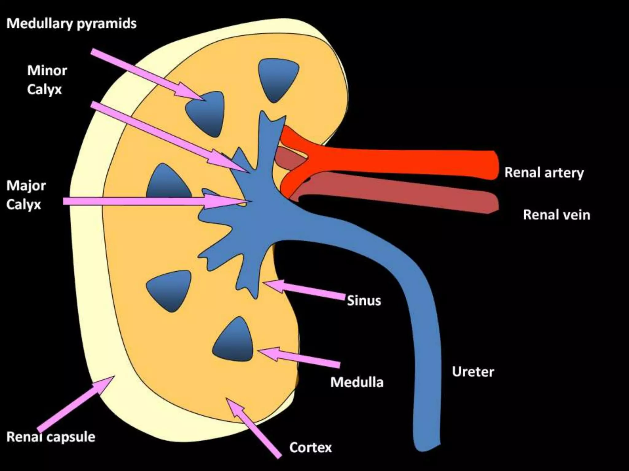 Ultrasound renal stone differential diagnosis . | PPTX