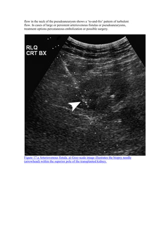 Ultrasound renal transplant | PDF