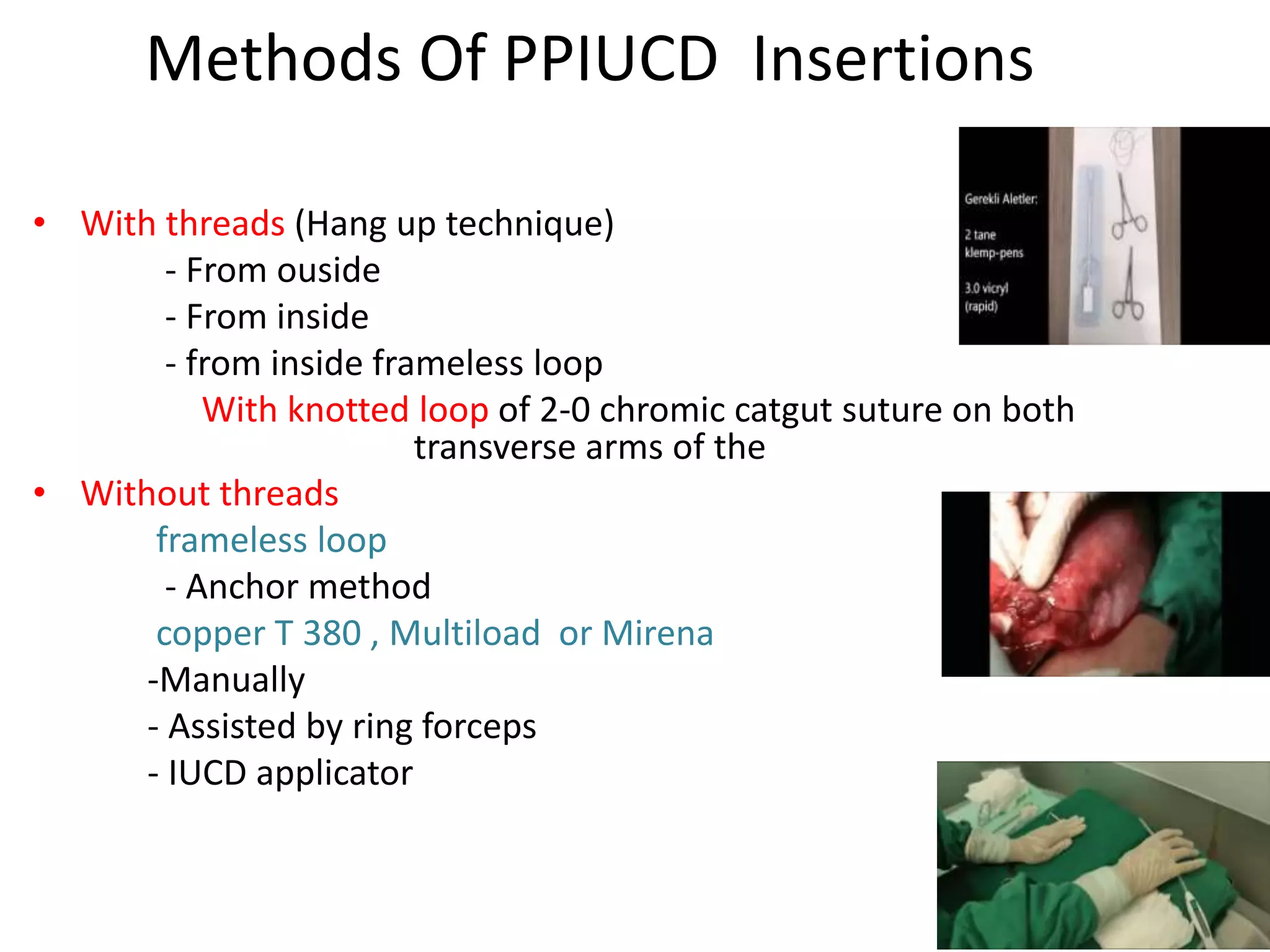 Role Of Ultrasound in assessment of iucd | PPTX | Birth Control ...