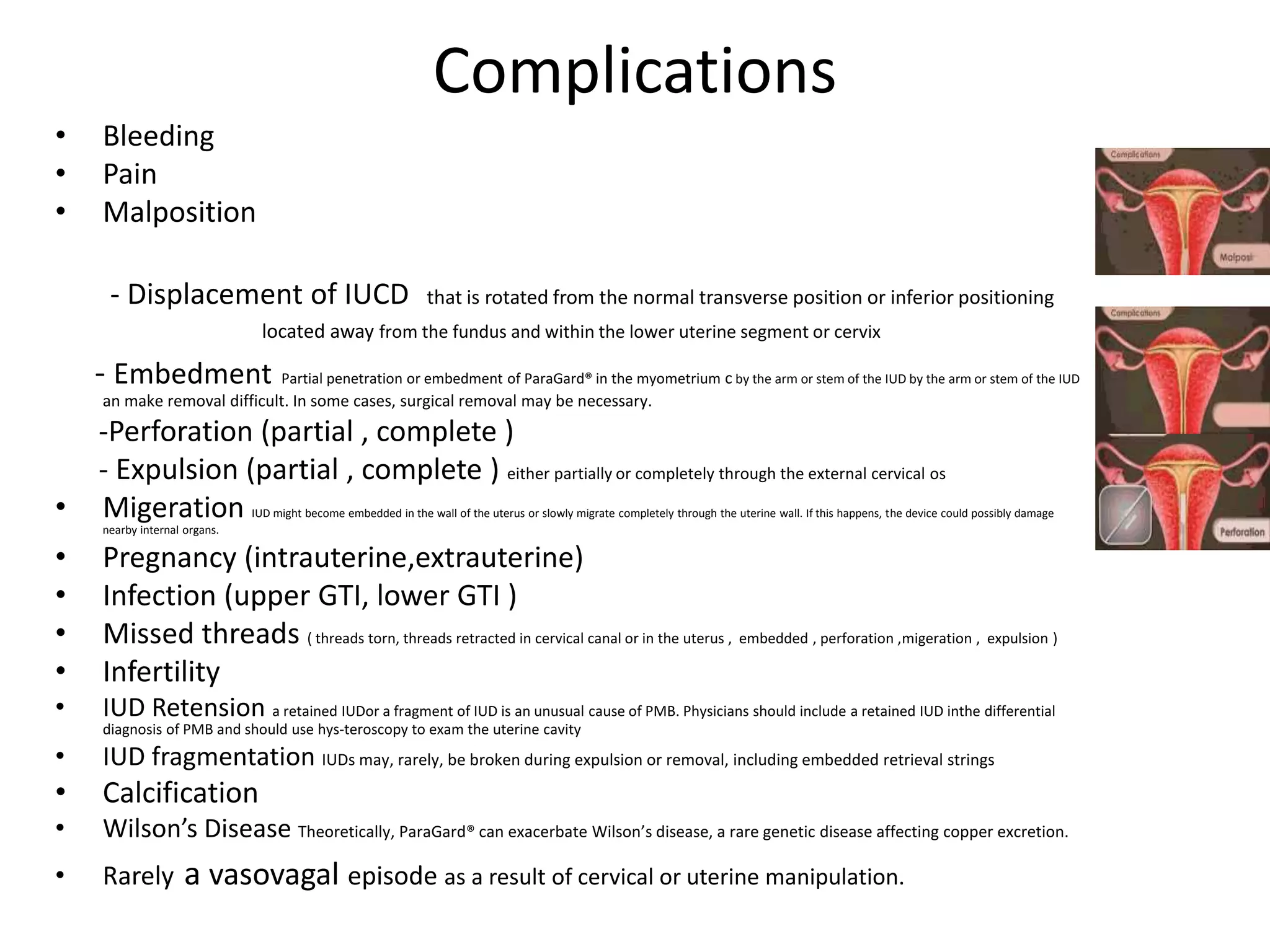 Role Of Ultrasound in assessment of iucd | PPTX