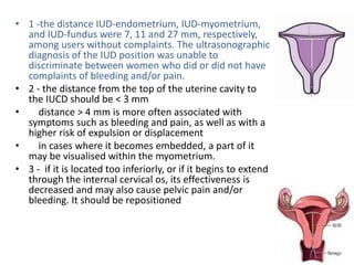 Role Of Ultrasound in assessment of iucd | PPTX