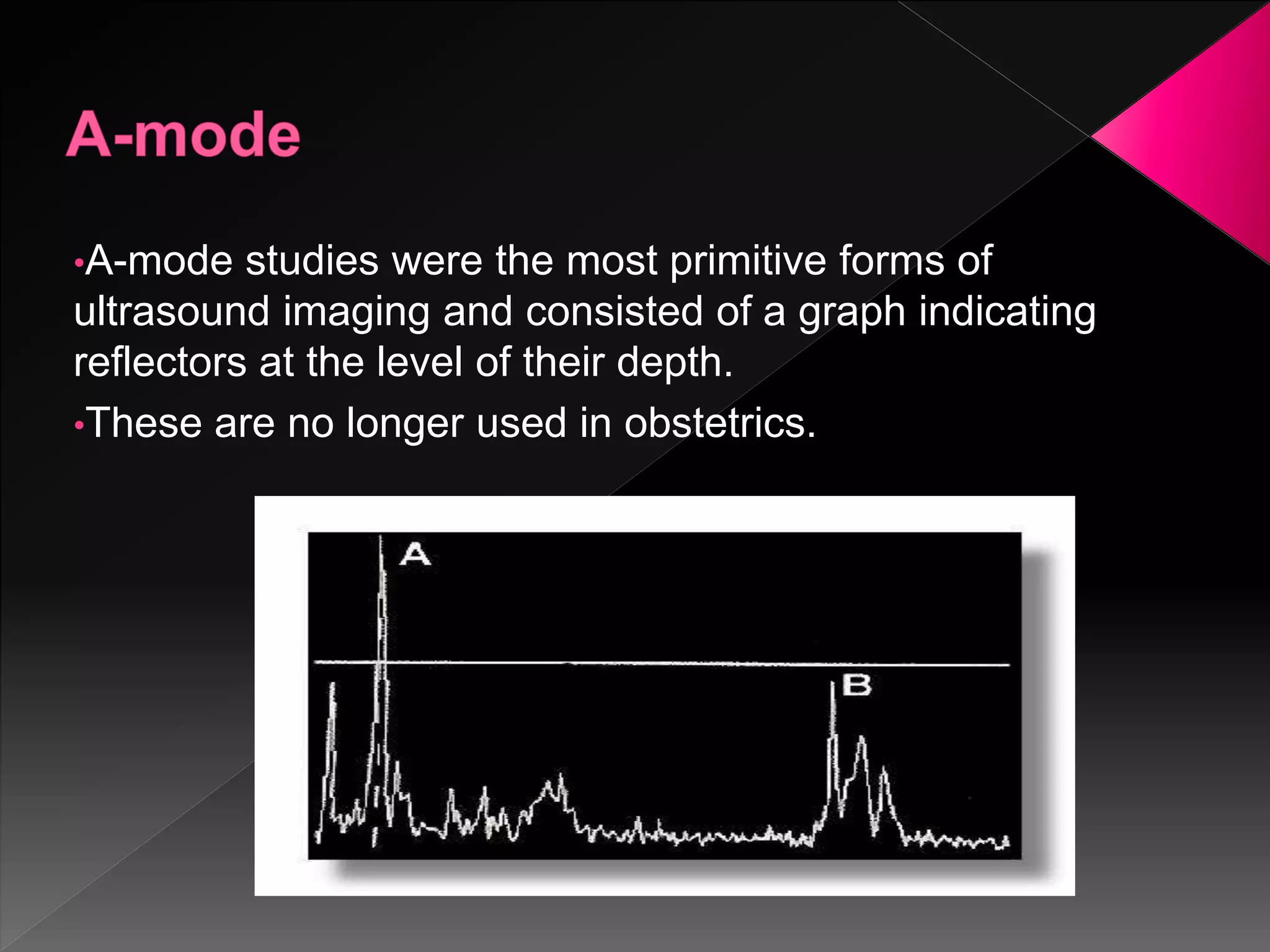 Ultrasound in obstetrics | PPTX