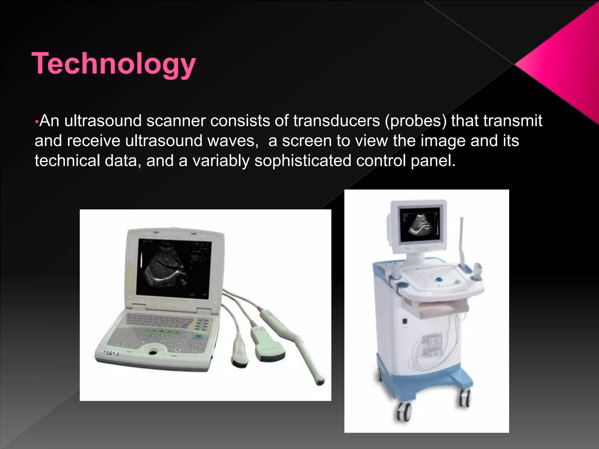 Ultrasound in obstetrics | PPTX