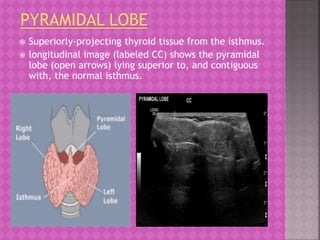 ULTRASOUND THYROID .pptx