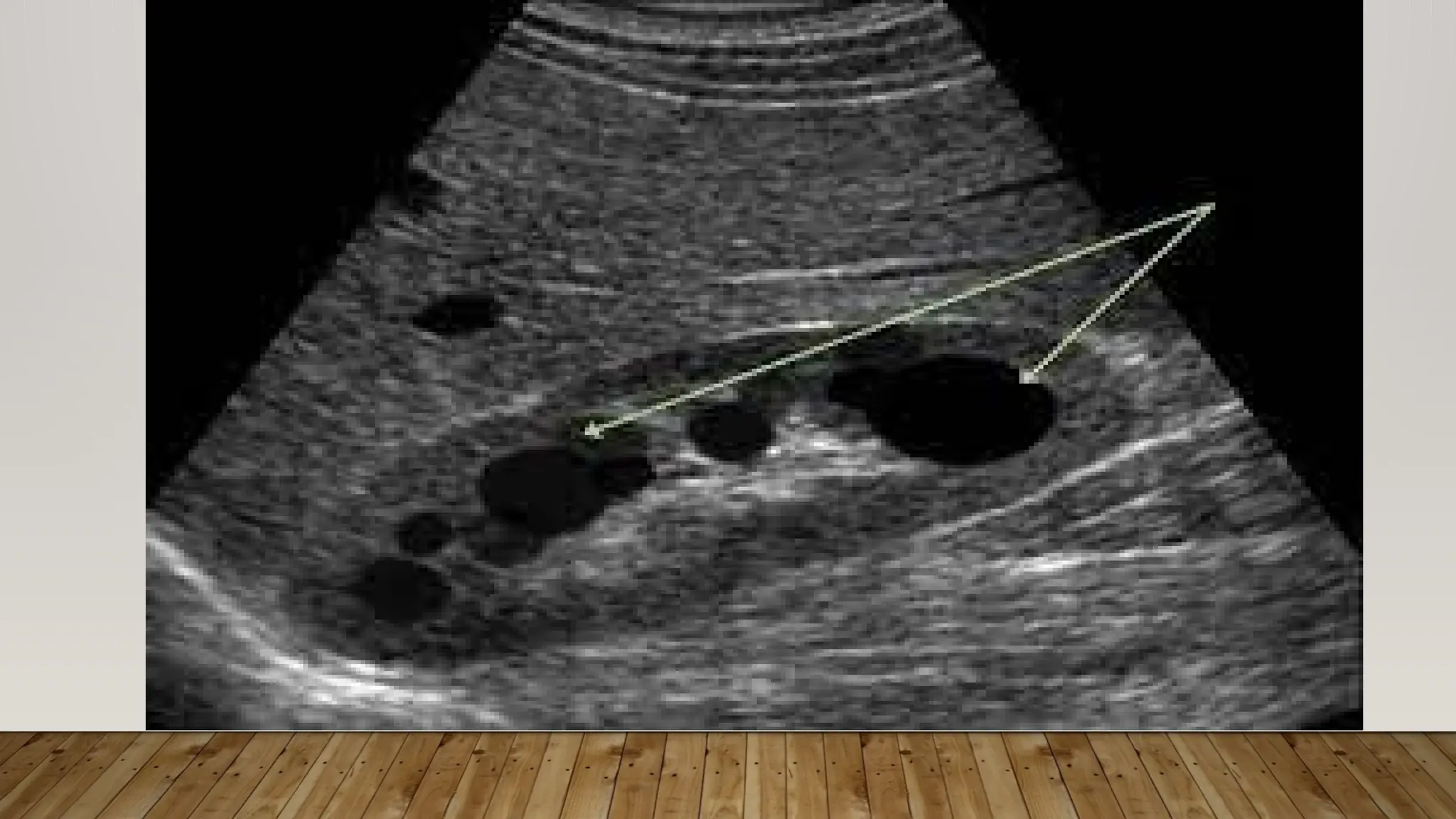 Ultrasound Tissue Characterization ,doppler | PPTX