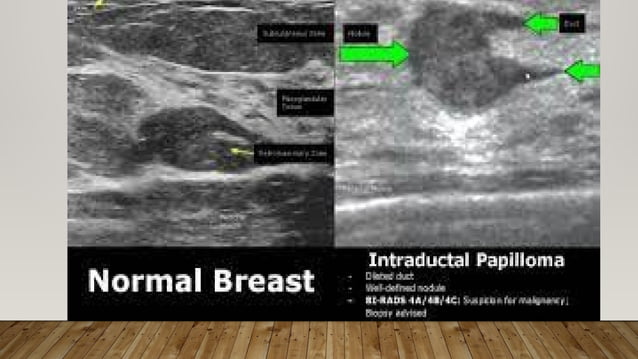 Ultrasound Tissue Characterization ,doppler | PPT