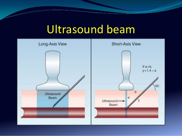 Ultrasound vascular access