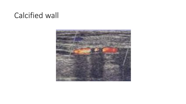 Ultrasound vascular mapping. | PDF