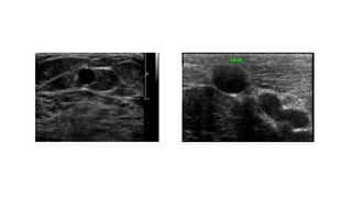 Ultrasound vascular mapping. | PDF