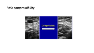 Ultrasound vascular mapping. | PDF